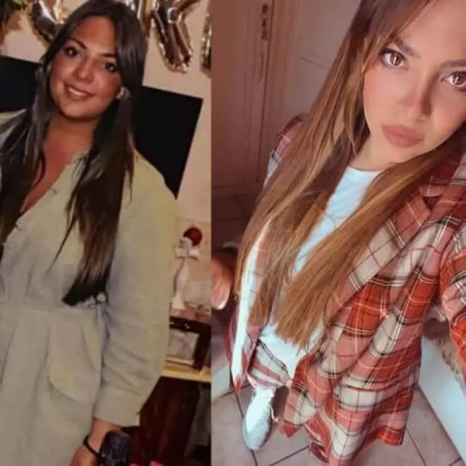 Resultados del Balon Gastrico Allurion | Medita Medical